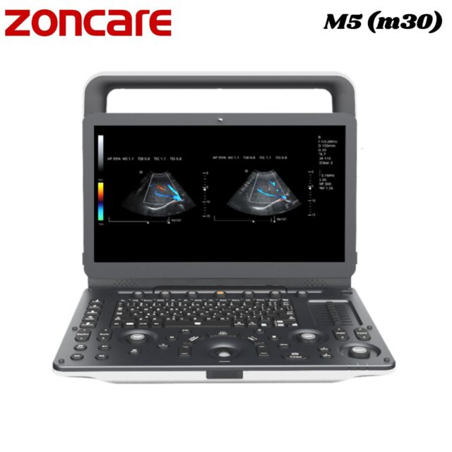 ECOGRAFO PORTATIL A COLOR ZONCARE M5 (m30) | EDUMED IMPORT