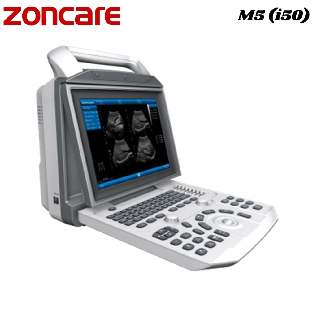 ECOGRAFO PORTATIL BLANCO Y NEGRO ZONCARE M5 (i50) | EDUMED IMPORT